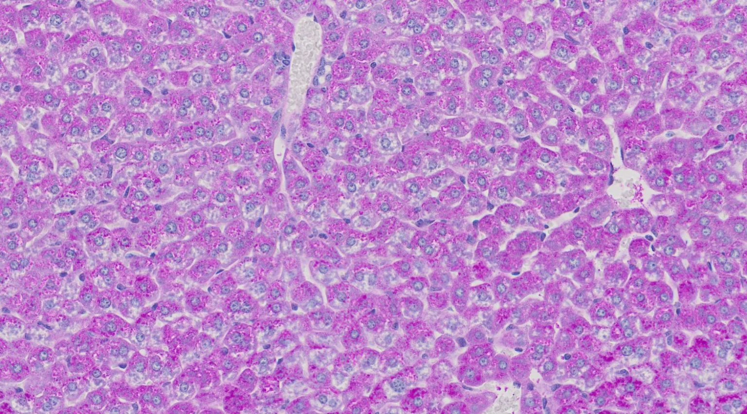 VitroView™ PAS Stain Kit