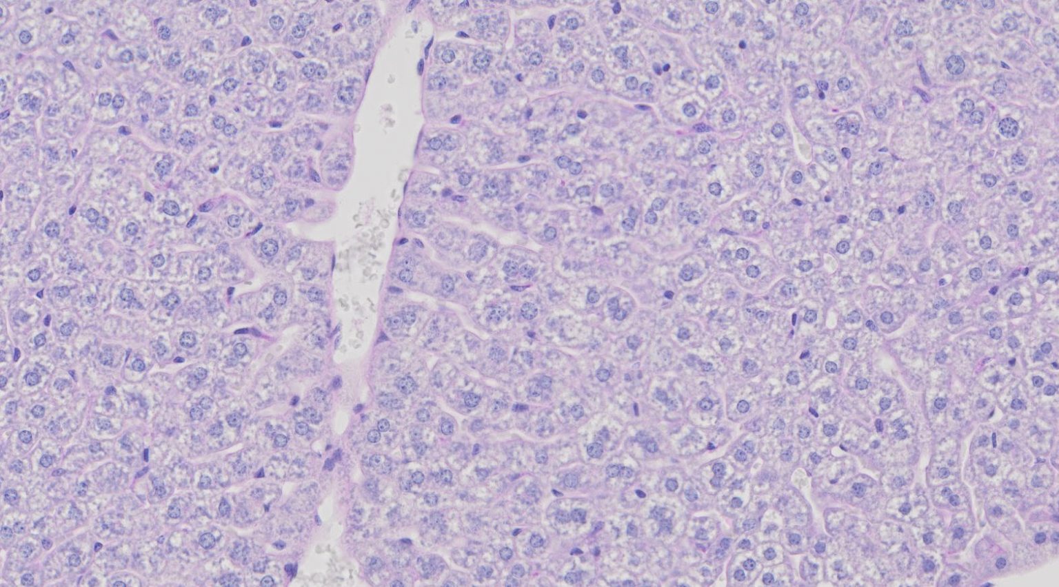 VitroView™ PAS Stain Kit