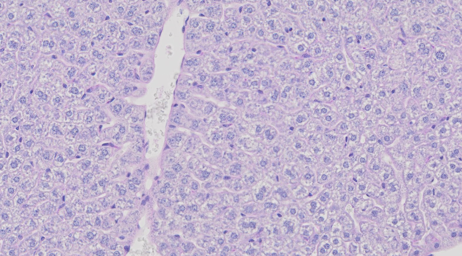 VitroView™ PAS Stain Kit