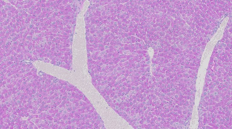 VitroView™ PAS Stain Kit