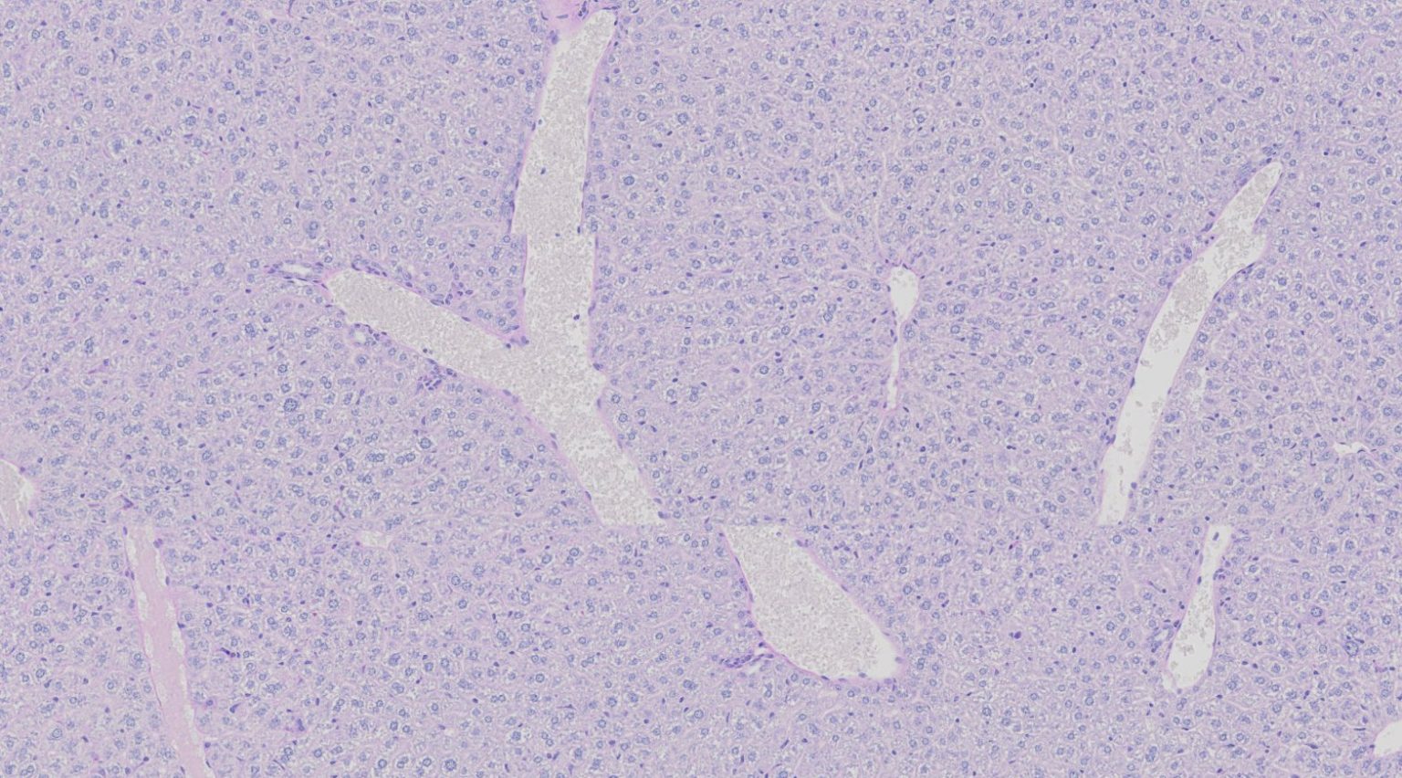 VitroView™ PAS Stain Kit