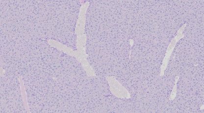 VitroView™ PAS Stain Kit