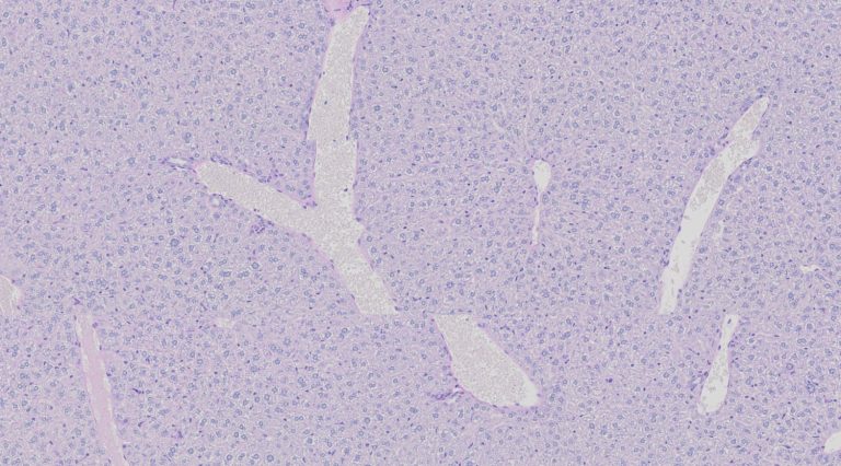 VitroView™ PAS Stain Kit