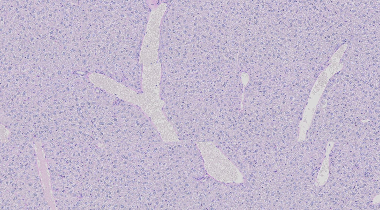 VitroView™ PAS Stain Kit