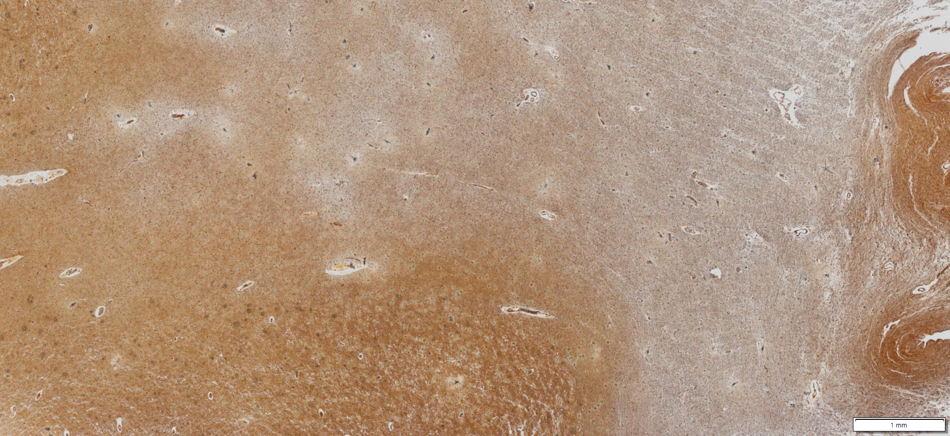 VitroView™ Bielschowsky's Silver Stain Kit - VitroVivo Biotech