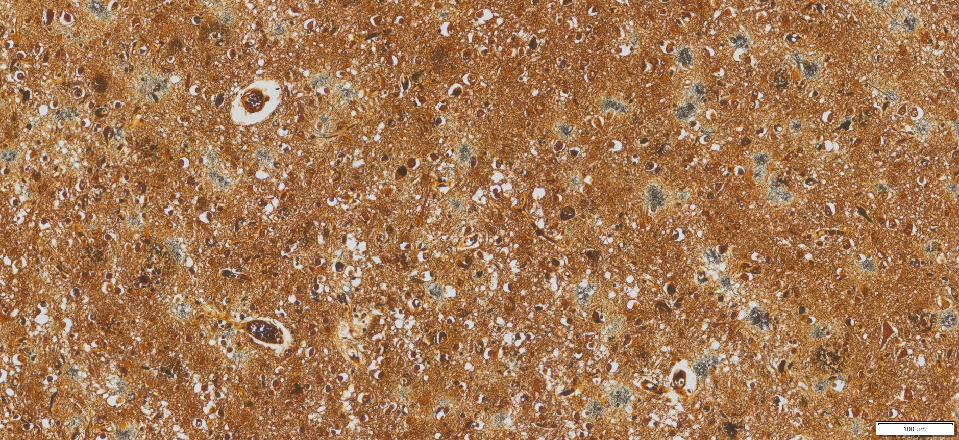 VitroView™ Bielschowsky's Silver Stain Kit - VitroVivo Biotech