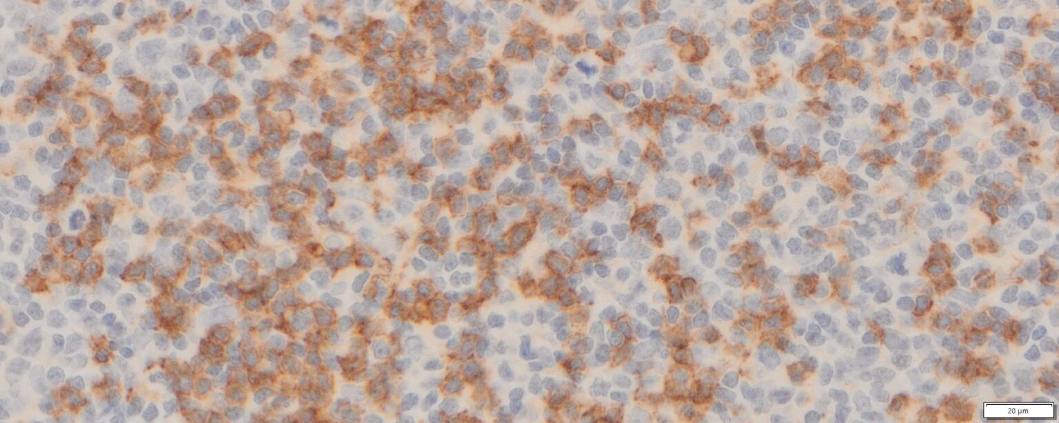 VitroView™ LSAB IHC-DAB Kit (Mouse IgG) (150 slides) - VitroVivo Biotech