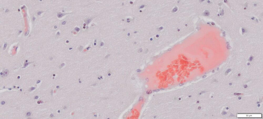 VitroView™ Congo Red Amyloid Stain Kit - VitroVivo Biotech