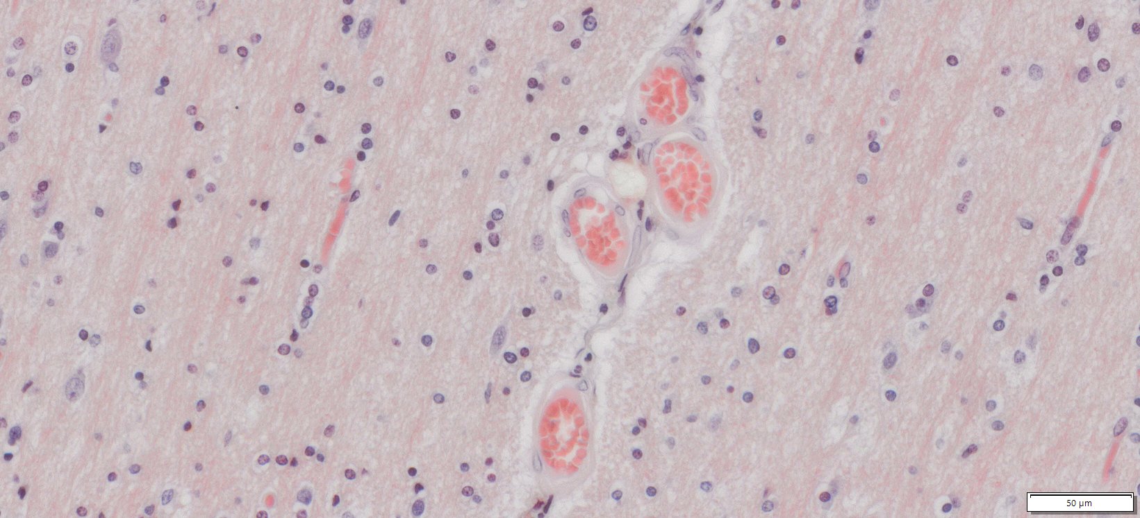 VitroView™ Congo Red Amyloid Stain Kit - VitroVivo Biotech