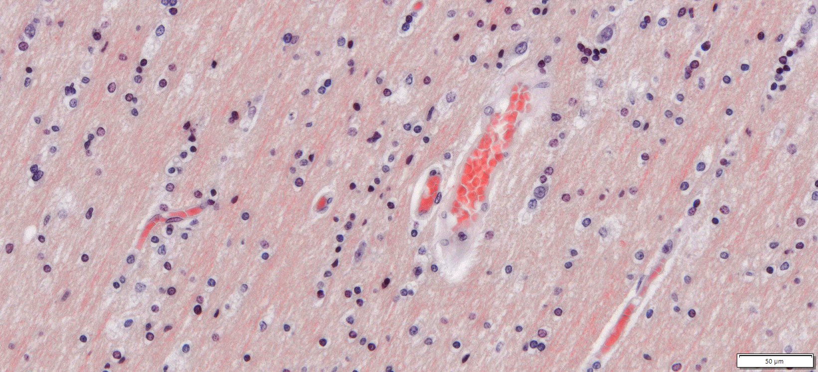 VitroView™ Congo Red Amyloid Stain Kit - VitroVivo Biotech