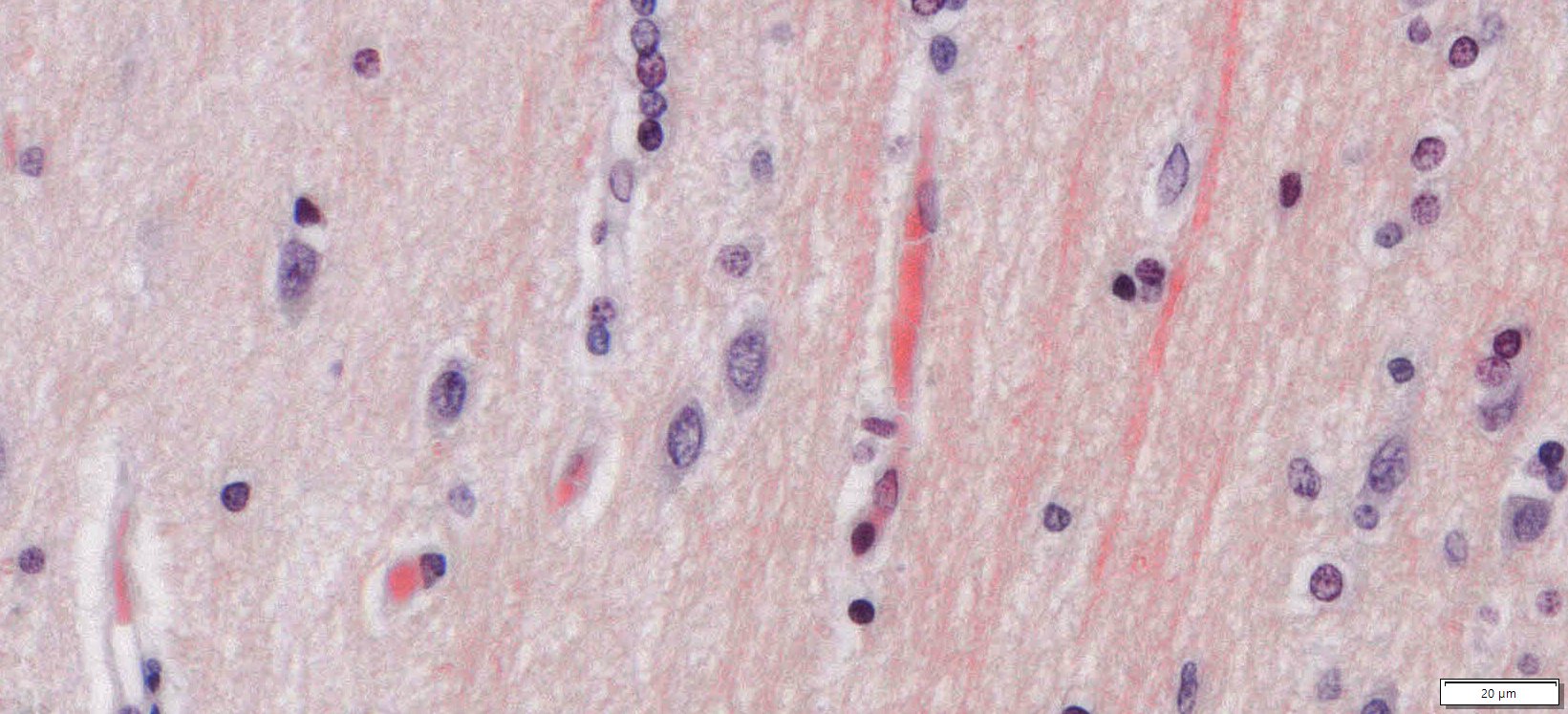 VitroView™ Congo Red Amyloid Stain Kit - VitroVivo Biotech