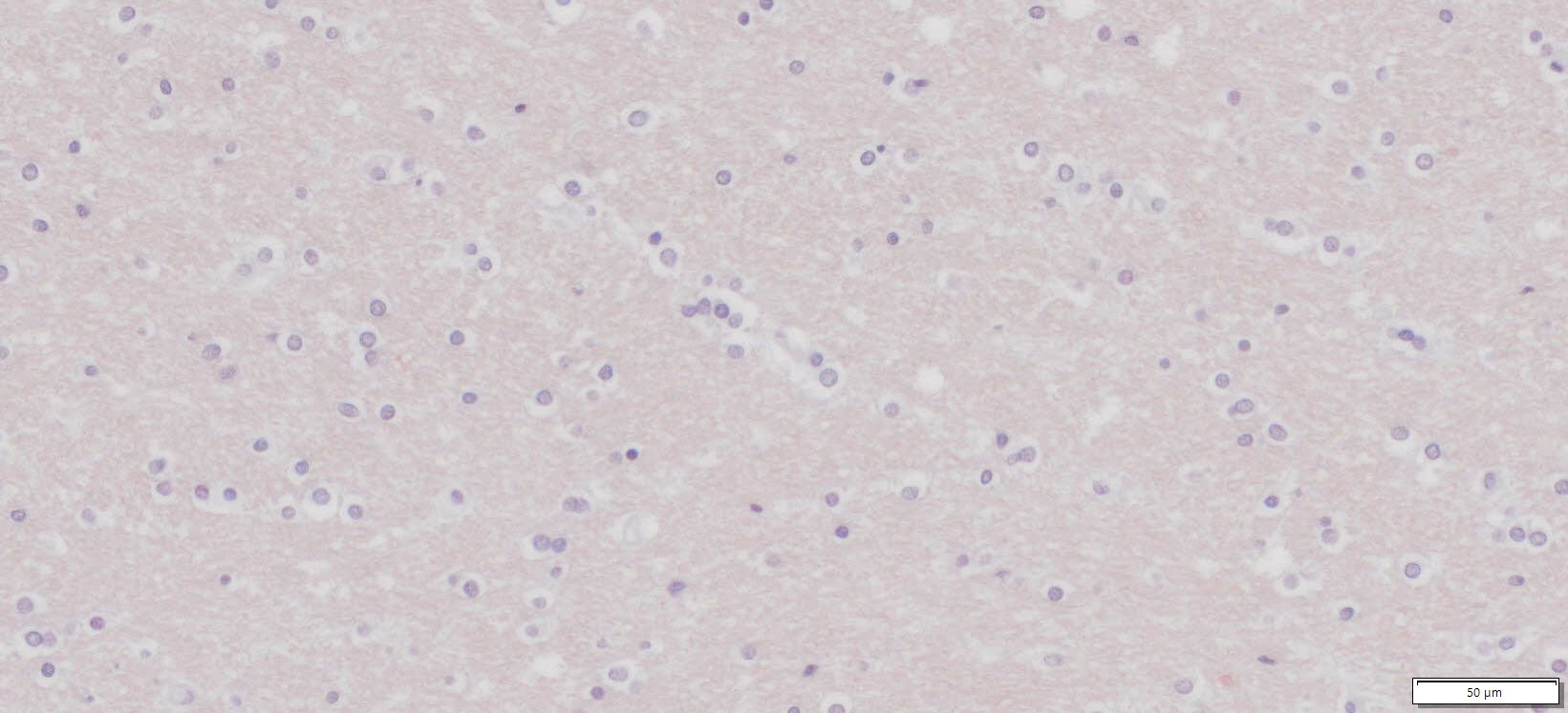 VitroView™ Congo Red Amyloid Stain Kit - VitroVivo Biotech