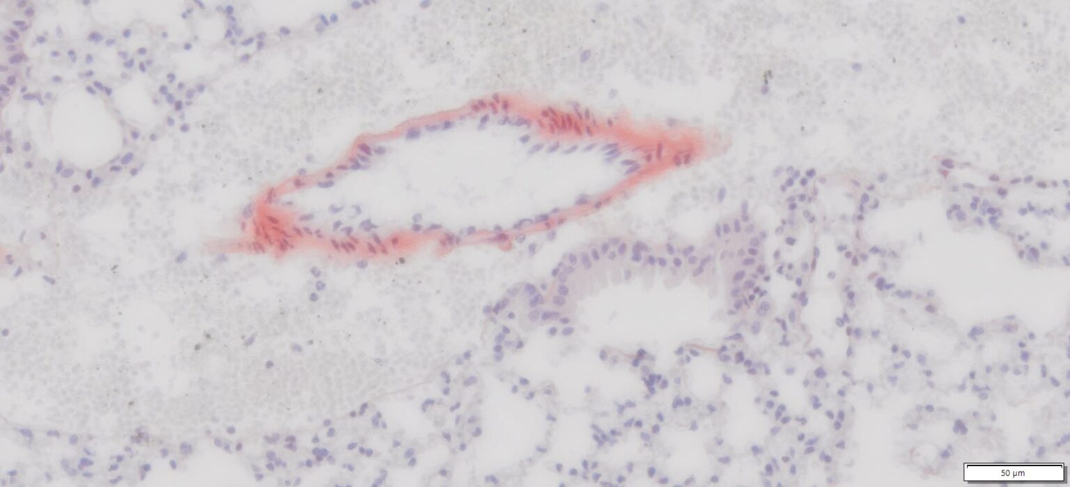 VitroView™ Congo Red Amyloid Stain Kit - VitroVivo Biotech