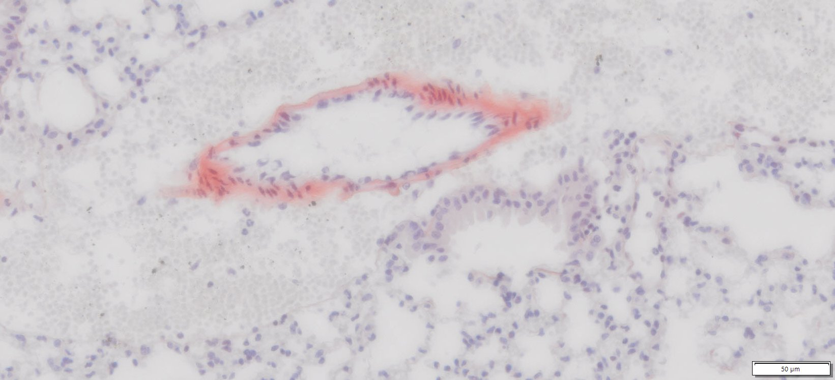 VitroView™ Congo Red Amyloid Stain Kit - VitroVivo Biotech