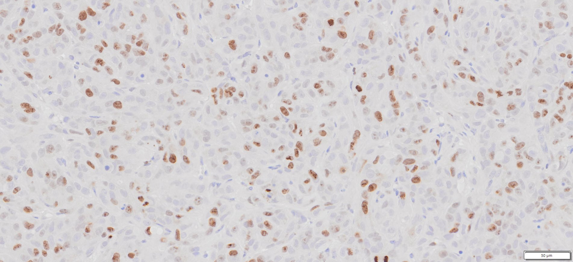 In Situ Ki67 IHC-DAB Kit (50 tests)
