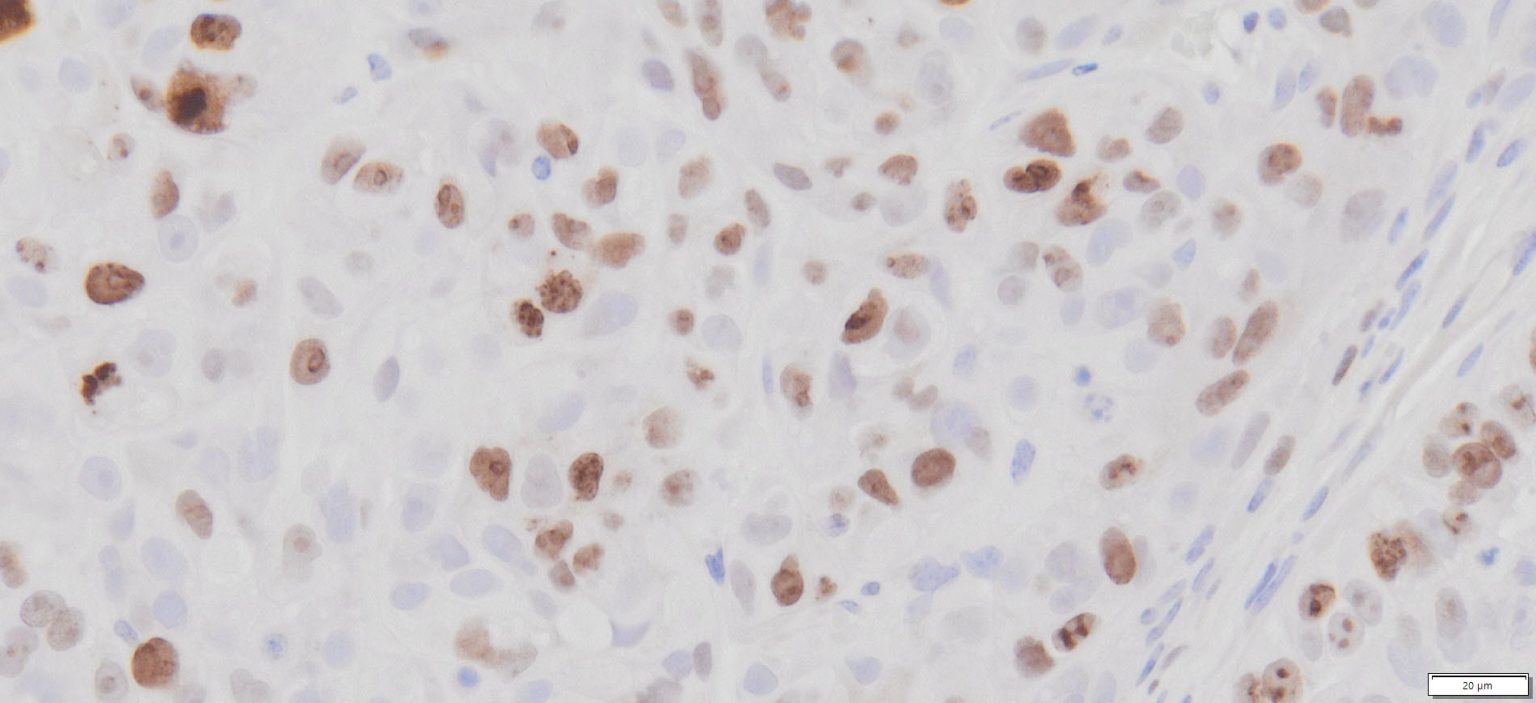 In Situ Ki67 IHC-DAB Kit (50 tests)