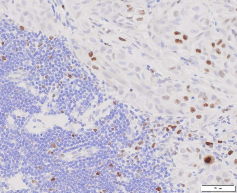 In Situ Ki67 IHC-DAB Kit (50 tests)