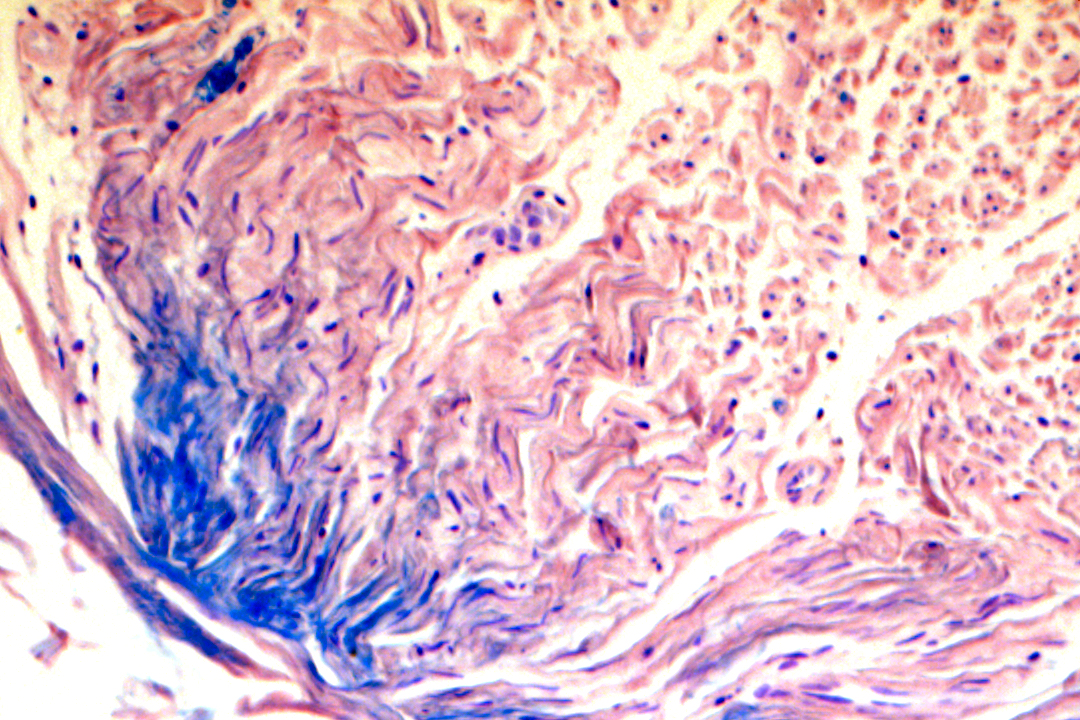 VitroView™ Luxol Fast Blue Stain Kit