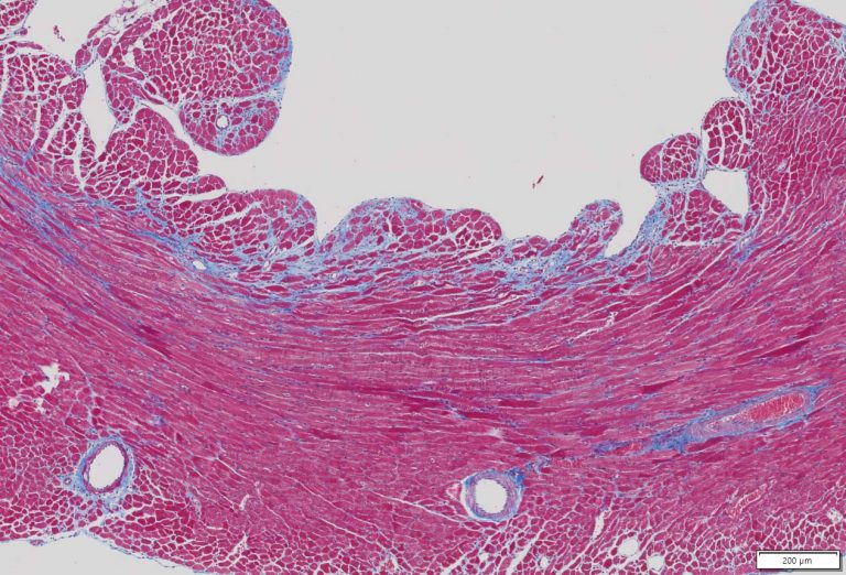 Trichrome Stain for FFPE And Frozen Tissue Slides