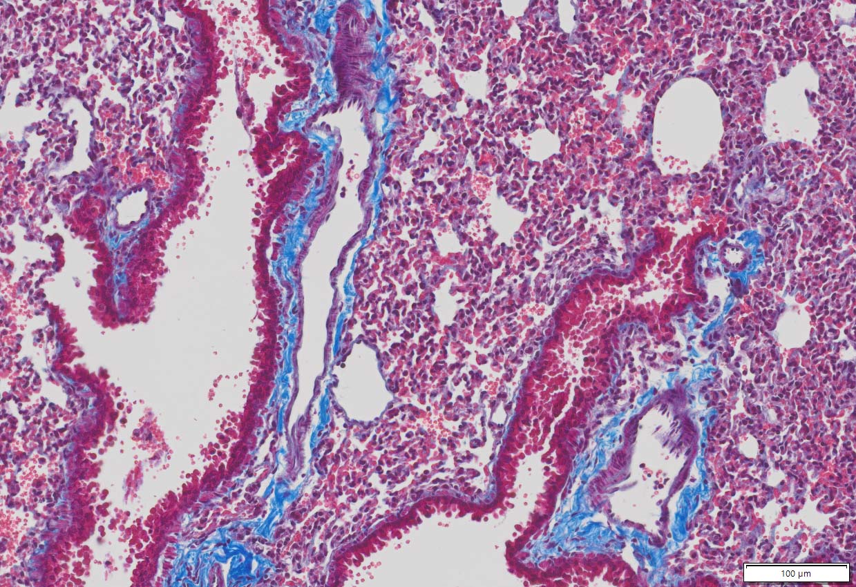 Trichrome Stain for FFPE And Frozen Tissue Slides