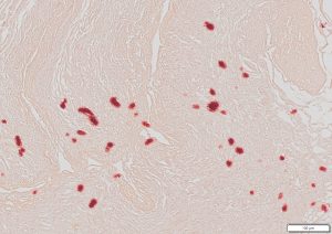 VitroView™ Alizarin Red Stain Kit - Tissue calcium staining