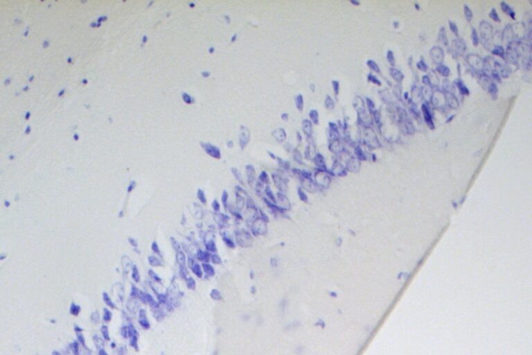 VitroView™ Nissl Stain Kit - Detection of Nissl body in the cytoplasm ...
