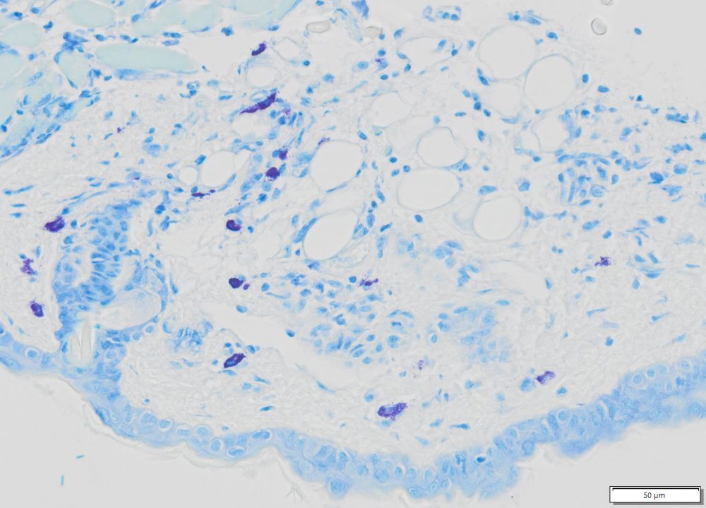 Stains for mast cells |Toluidine Blue Stain Kit
