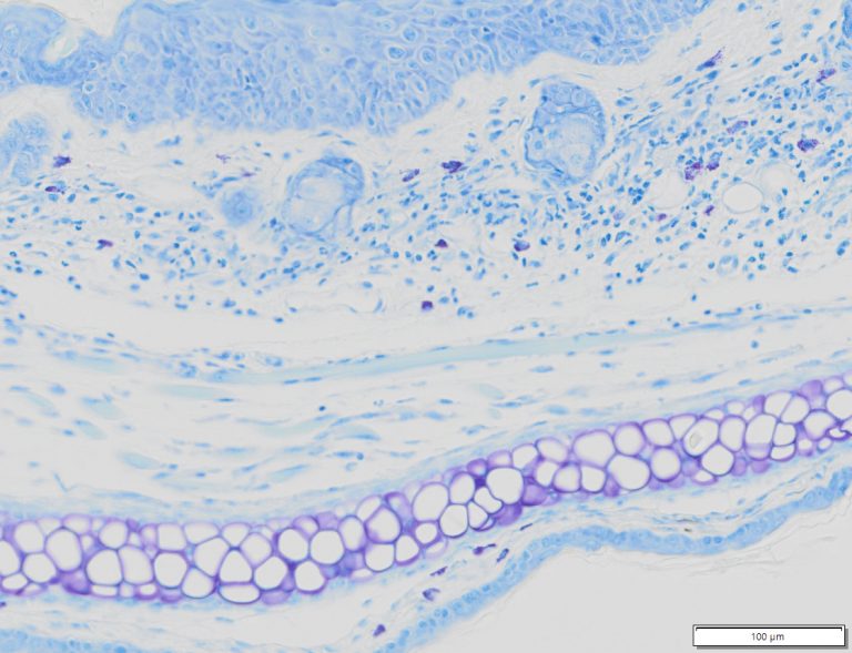 Stains for mast cells |Toluidine Blue Stain Kit