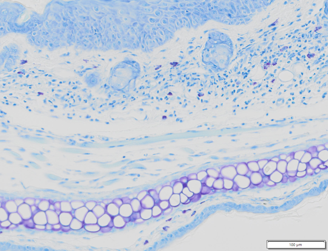 Stains for mast cells |Toluidine Blue Stain Kit