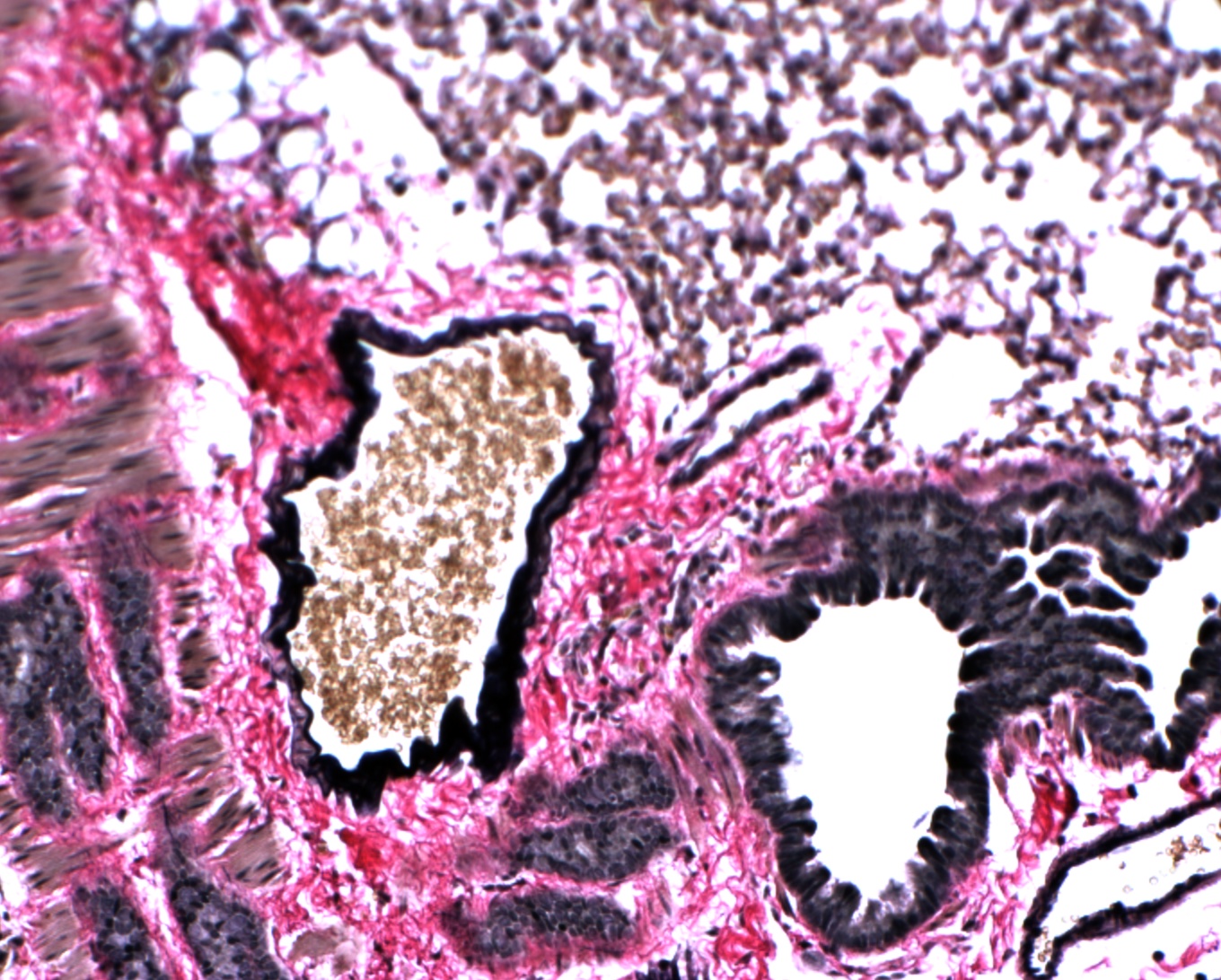 VitroView™ Verhoeff Van Gieson Elastin Stain Kit