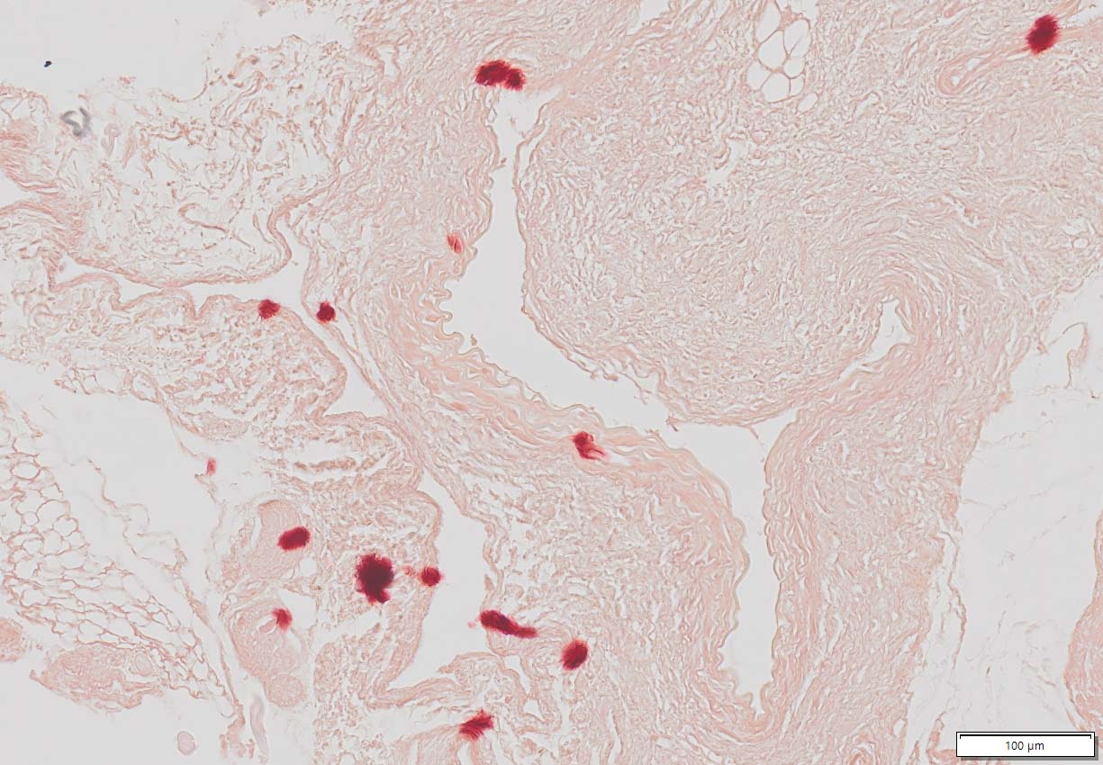 VitroView™ Alizarin Red Stain Kit - Tissue calcium staining