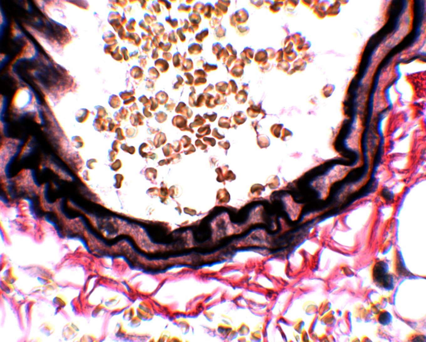 VitroView™ Verhoeff Van Gieson Elastin Stain Kit