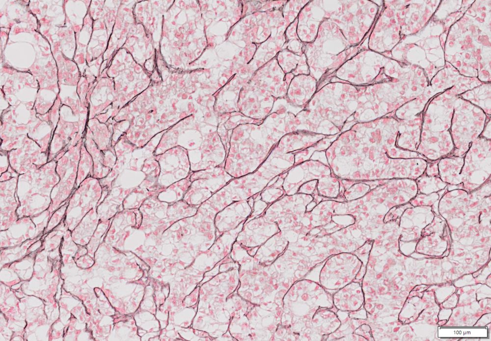 VitroView™ Reticulum Stain Kit