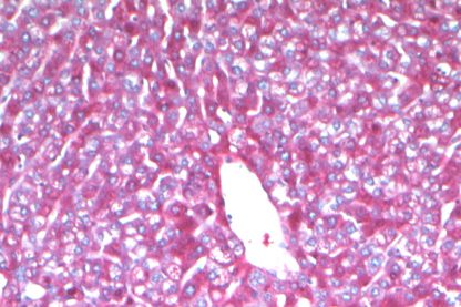 VitroView™ PAS Stain Kit