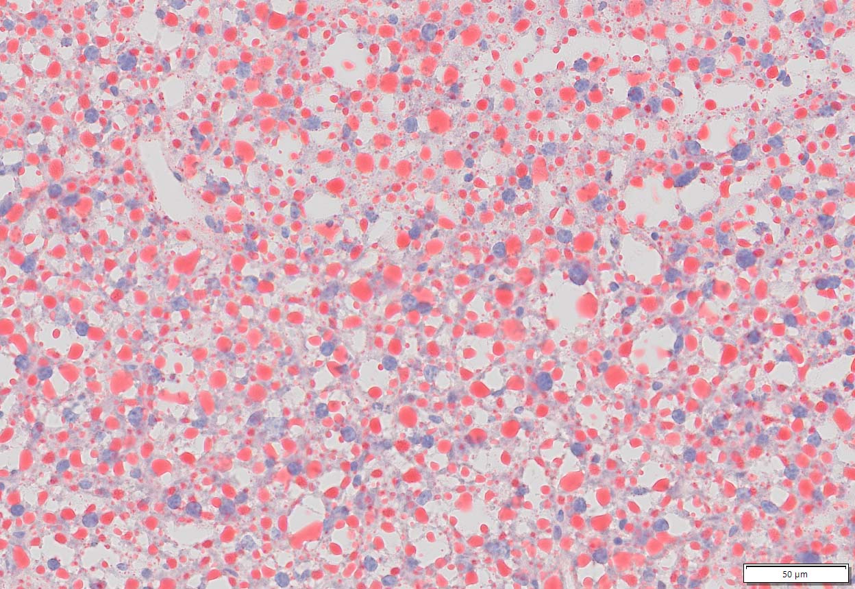 Oil Red O Staining | Stain Kit Online