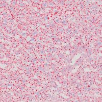 VitroView™ Alizarin Red Stain Kit - Tissue calcium staining