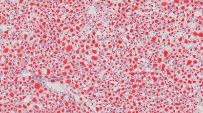 Oil Red O Staining | Stain Kit Online