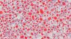 Oil Red O Staining | Stain Kit Online