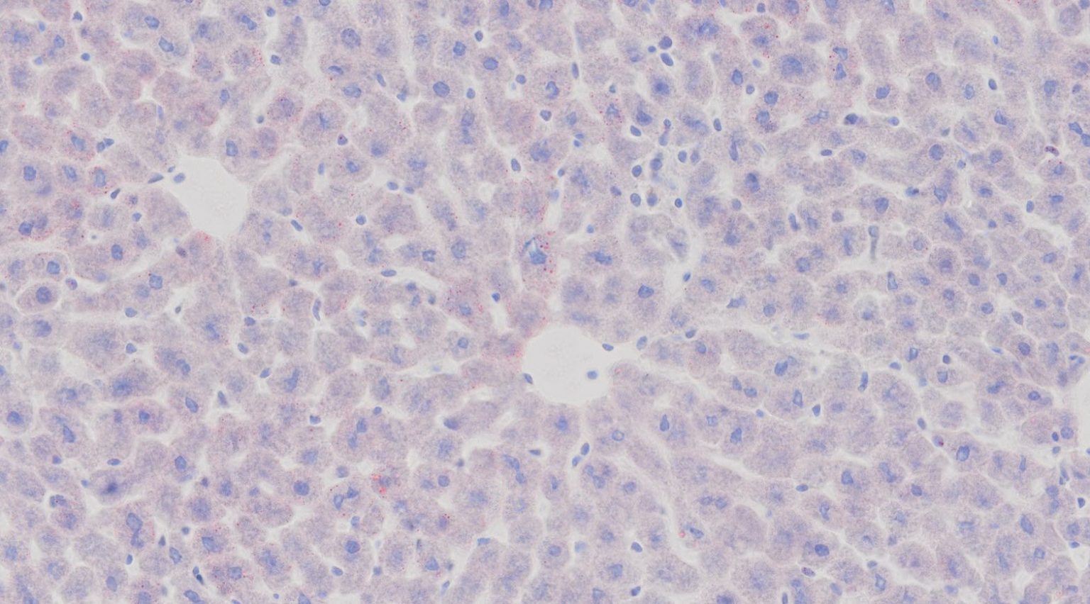 Oil Red O Staining | Stain Kit Online