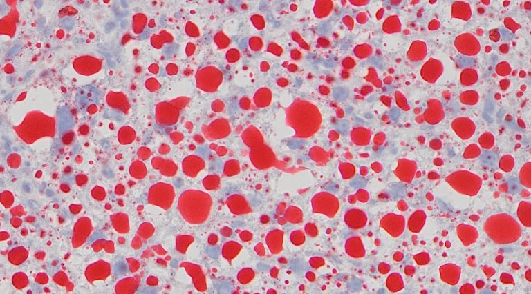 Oil Red O Staining | Stain Kit Online