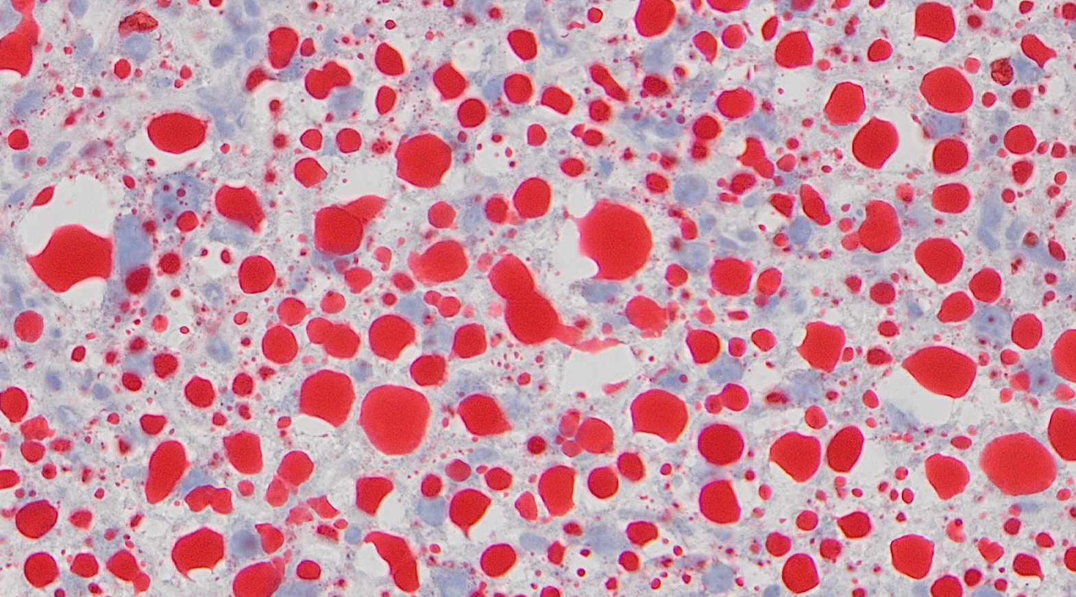 Oil Red O Staining | Stain Kit Online