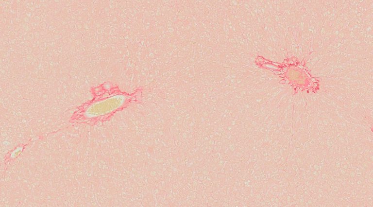 VitroView™ Picro-Sirius Red Stain Kit - VitroVivo Biotech