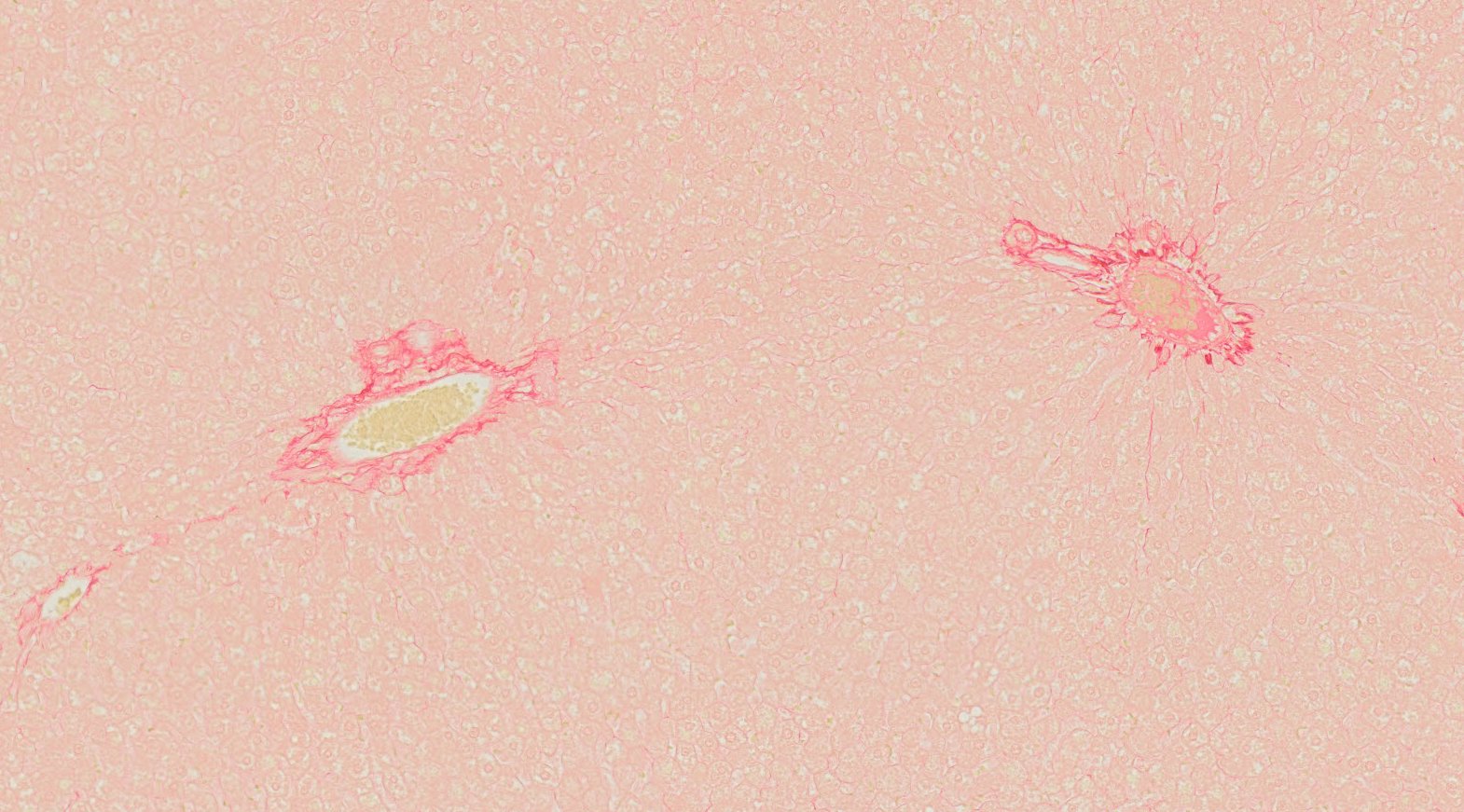 Vitroview™ Picro Sirius Red Stain Kit Vitrovivo Biotech