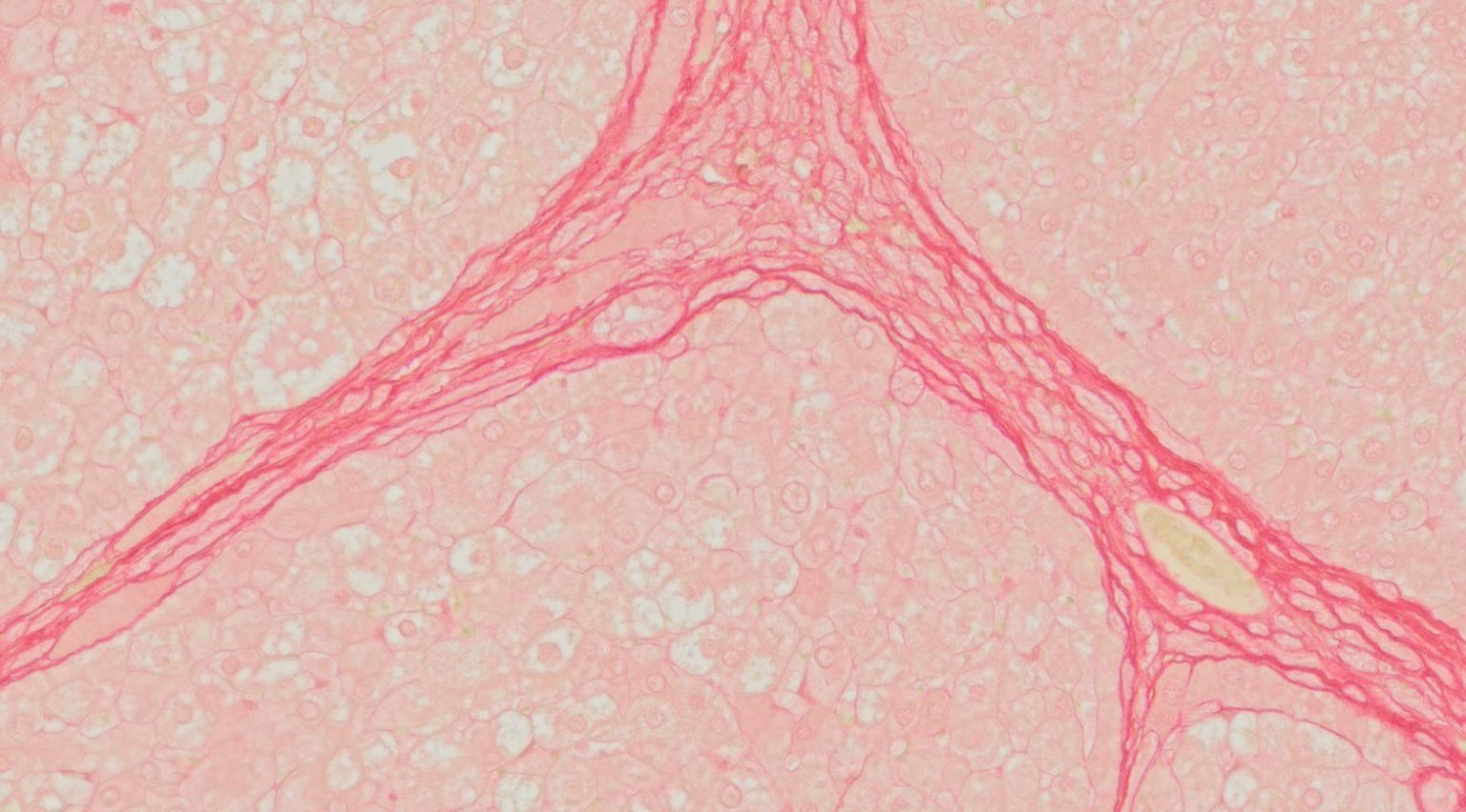 VitroView™ Picro-Sirius Red Stain Kit - VitroVivo Biotech