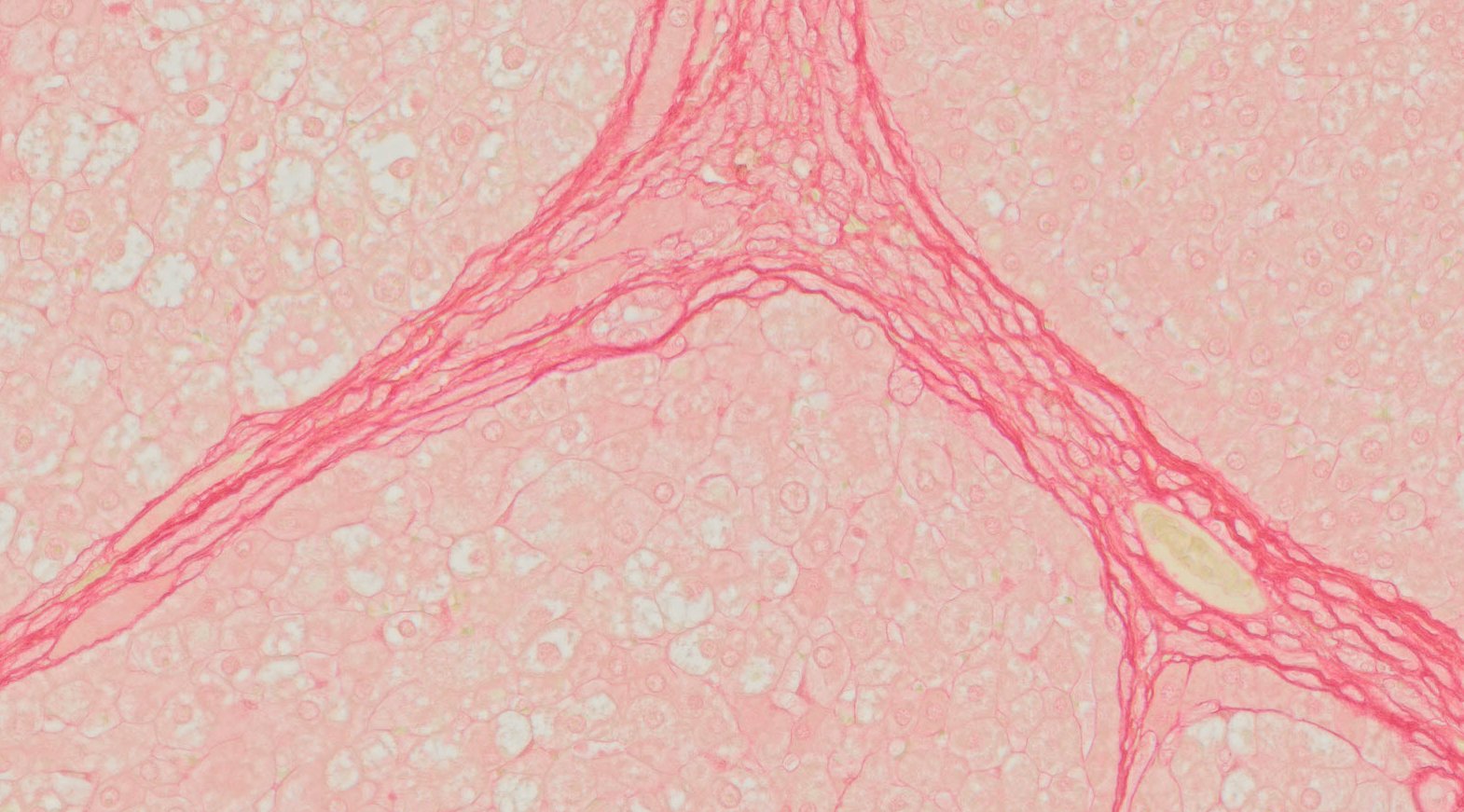 VitroView™ Picro-Sirius Red Stain Kit - VitroVivo Biotech