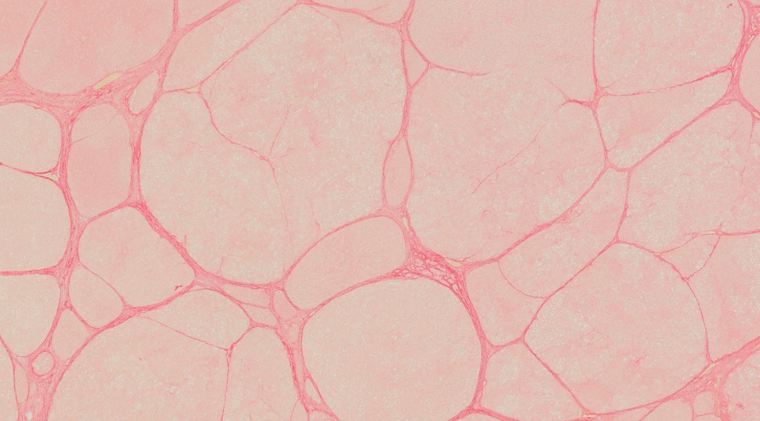 VitroView™ Picro-Sirius Red Stain Kit - VitroVivo Biotech