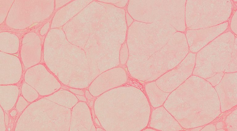 VitroView™ Picro-Sirius Red Stain Kit - VitroVivo Biotech