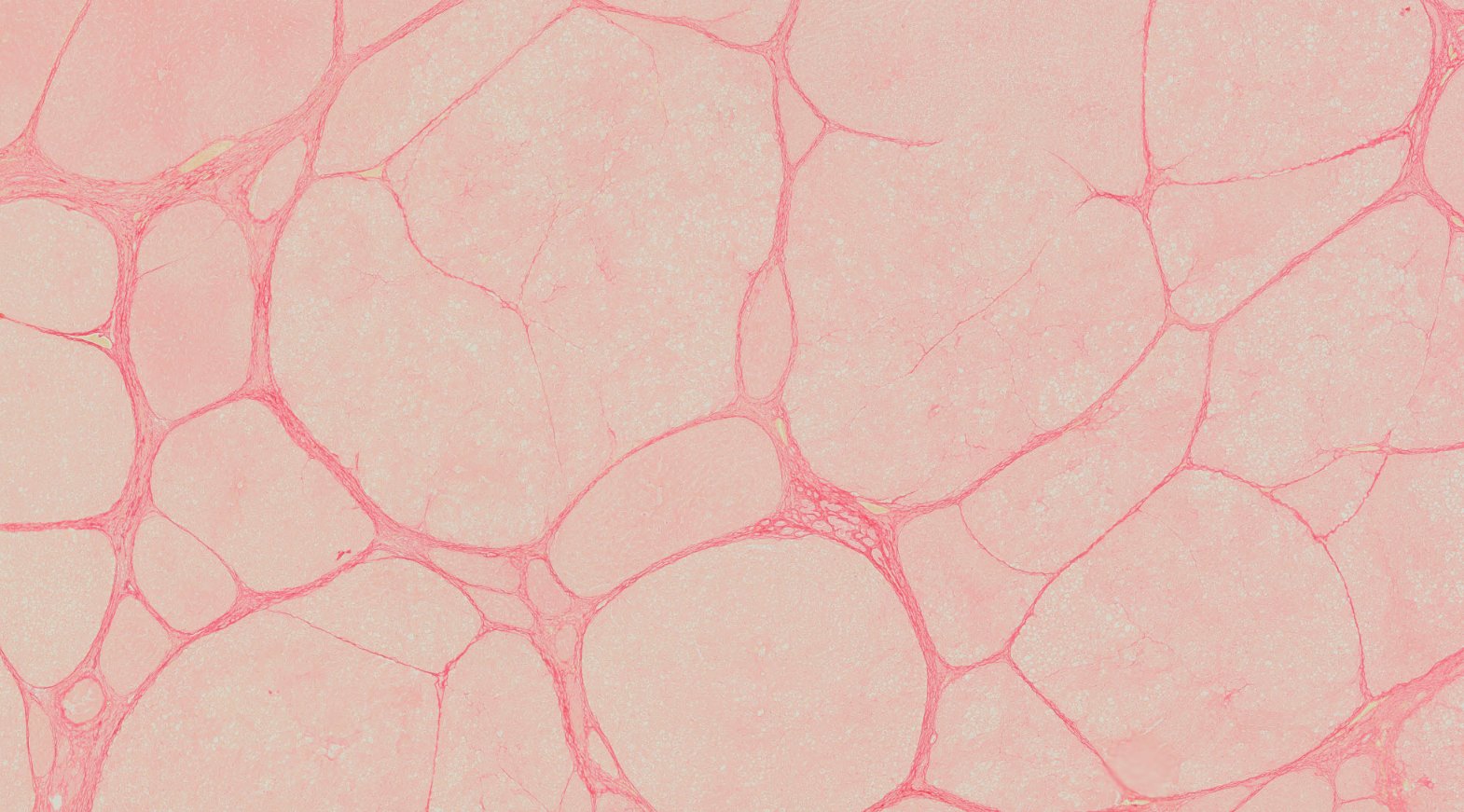 VitroView™ Picro-Sirius Red Stain Kit - VitroVivo Biotech