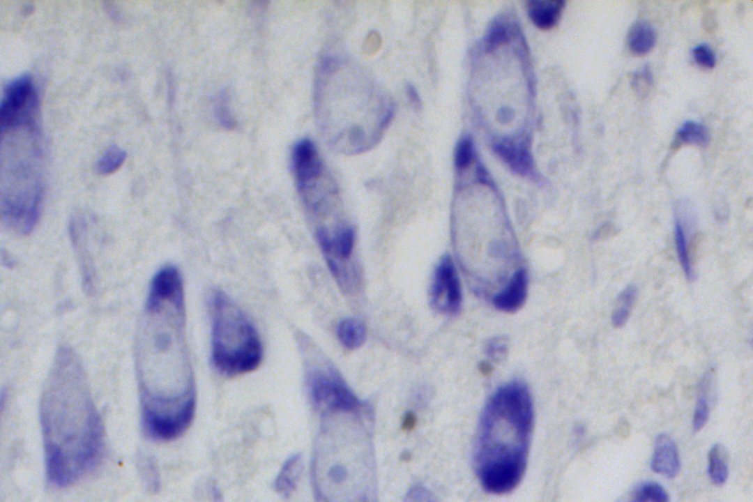 VitroView™ Nissl Stain Kit - Detection of Nissl body in the cytoplasm ...