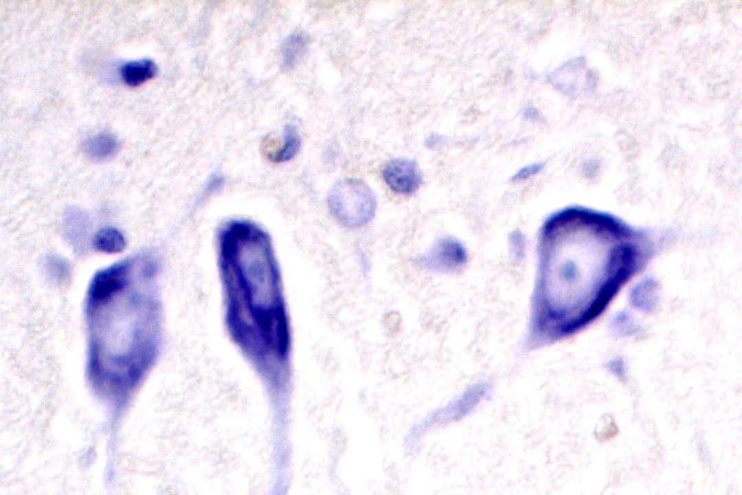 VitroView™ Nissl Stain Kit - Detection of Nissl body in the cytoplasm ...